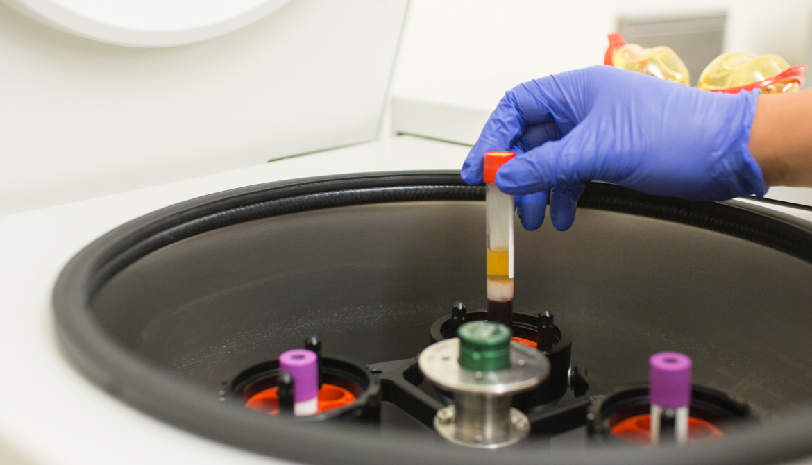 Evidence of Autoimmunity’s Origins Uncovered - The Rheumatology Lab